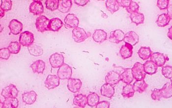 Campylobacter fetus