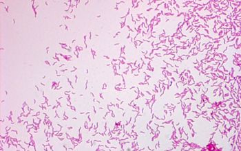 Campylobacter fetus
