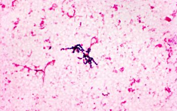 Streptococcus intermedius