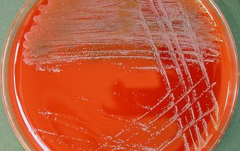 Streptococcus intermedius
