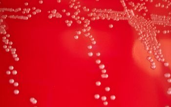 Streptococcus intermedius