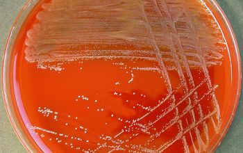 Streptococcus intermedius